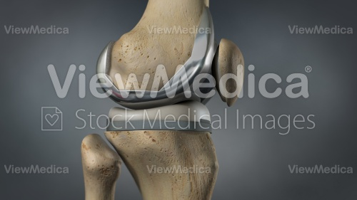 ViewMedica